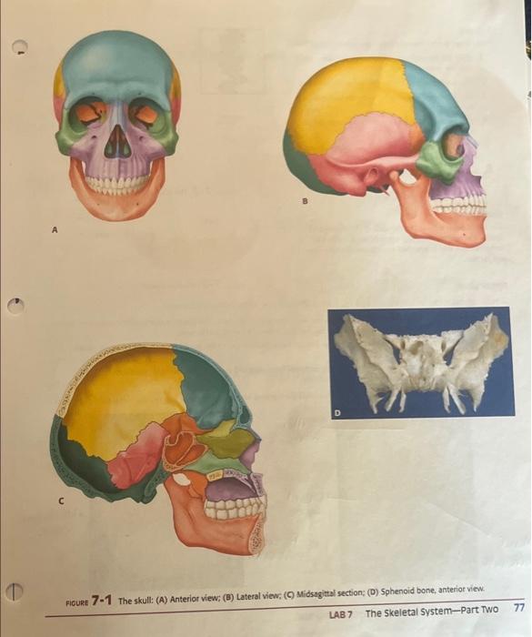 Solved Orbit of the Eye The bones of the orbit of the eye | Chegg.com