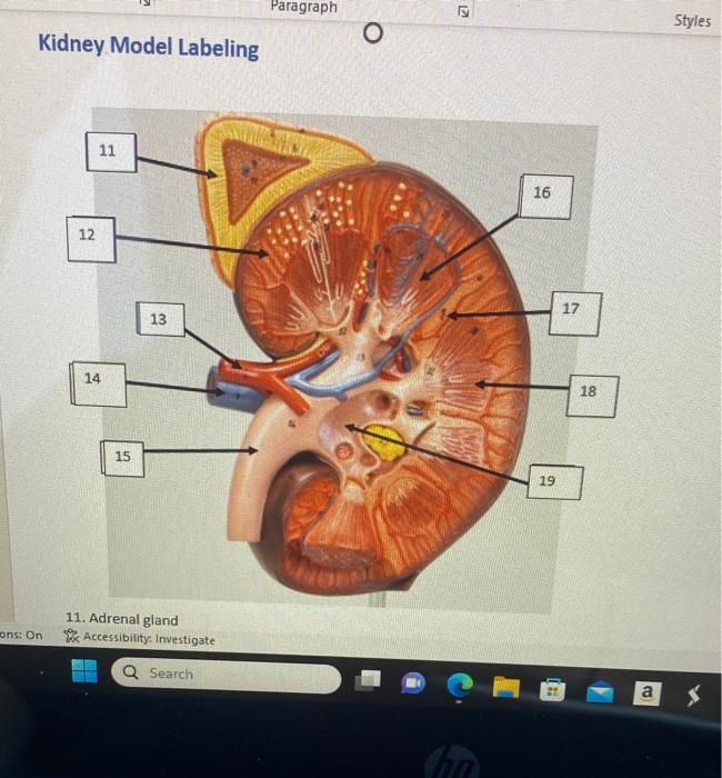 Solved 4. Major calyx 5. renal cortex Kidney Model | Chegg.com
