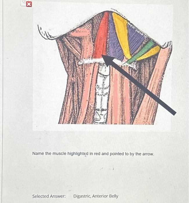 Solved Question | Chegg.com