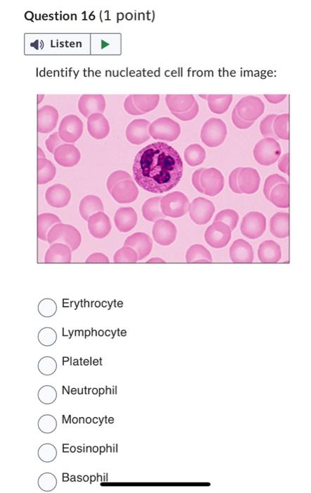 [Solved]: What are the most numerous types of cells in red