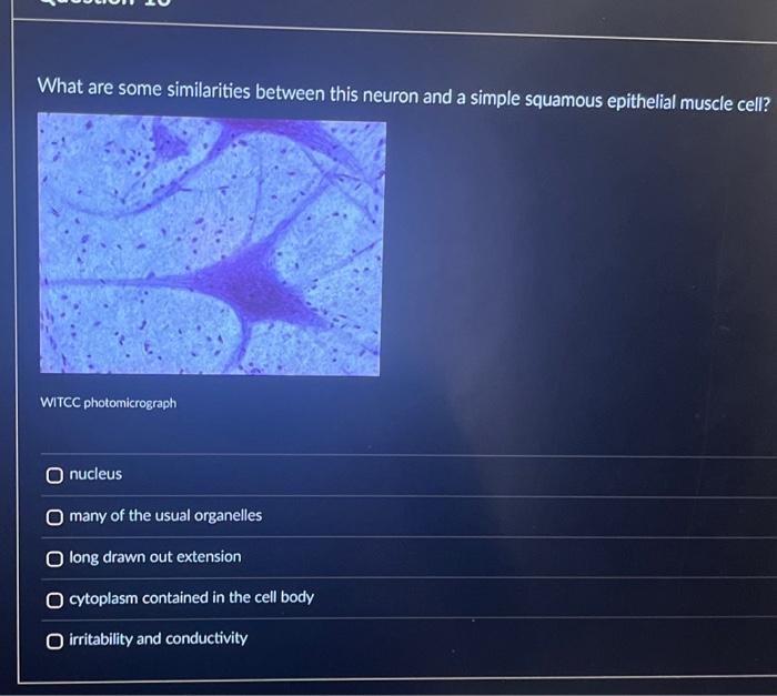 Solved What are some similarities between this neuron and a | Chegg.com