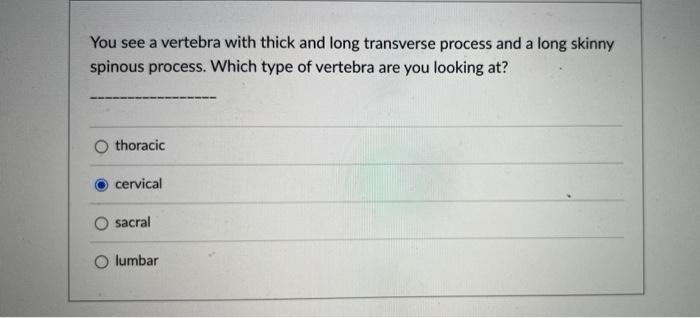 You see a vertebra with thick and long transverse | Chegg.com