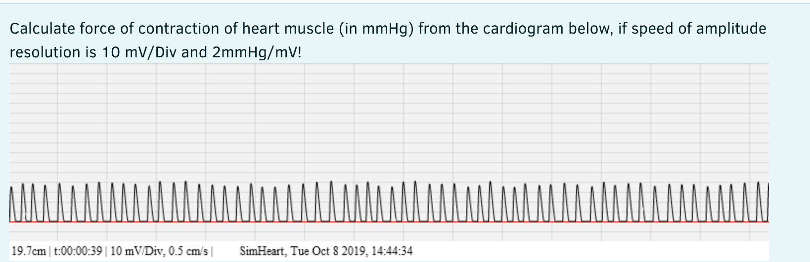 Solved Calculate heart rate (in xmin ) ﻿from the cardiogram | Chegg.com