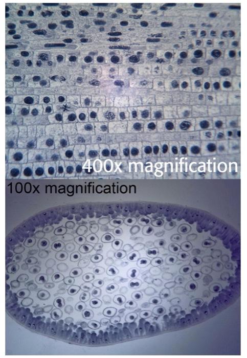 Solved How many cells are interphase, prophase, metaphase, | Chegg.com