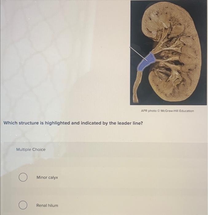 Solved APR photo o McGraw-Hill Education Which structure is | Chegg.com