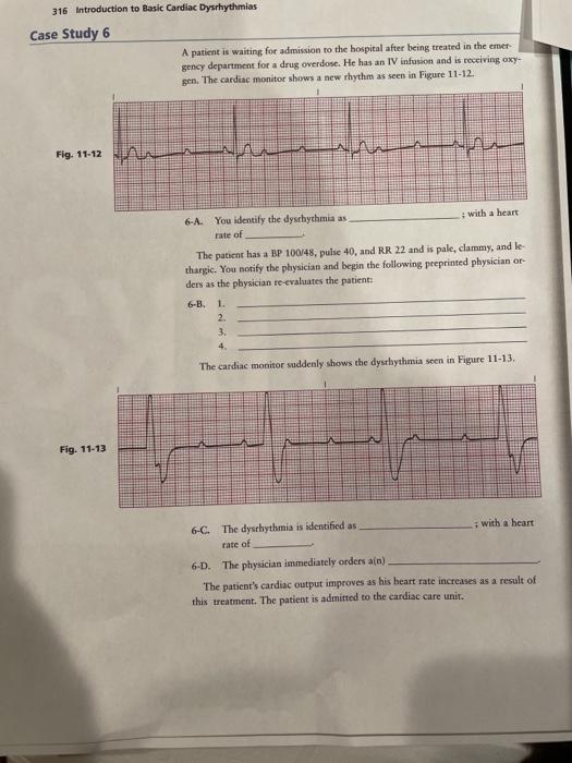 Solved 316 Introduction to Basic Cardiac Dysrhythmias Case | Chegg.com