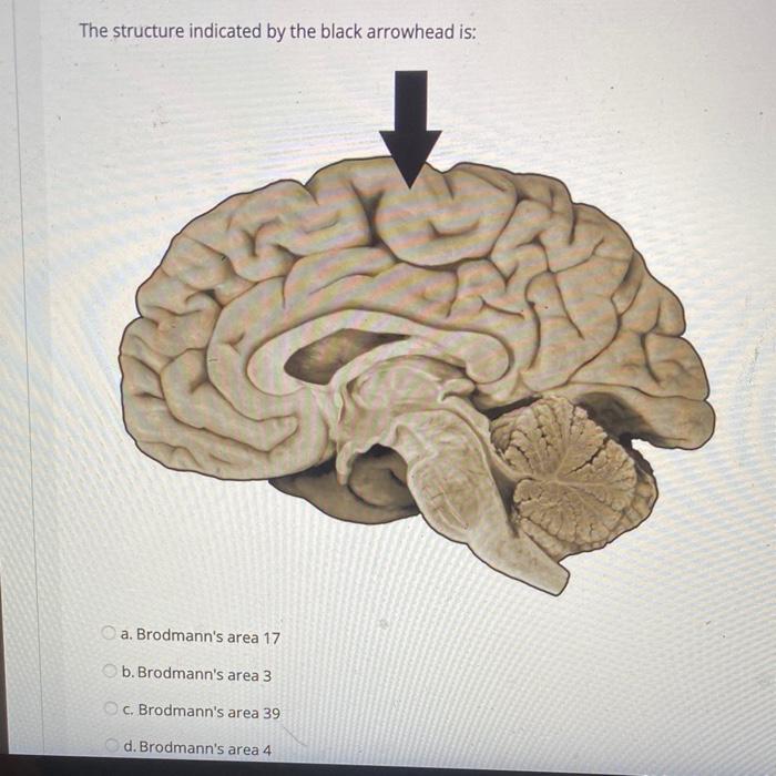 Solved These 2 structures indicated by the arrows are | Chegg.com