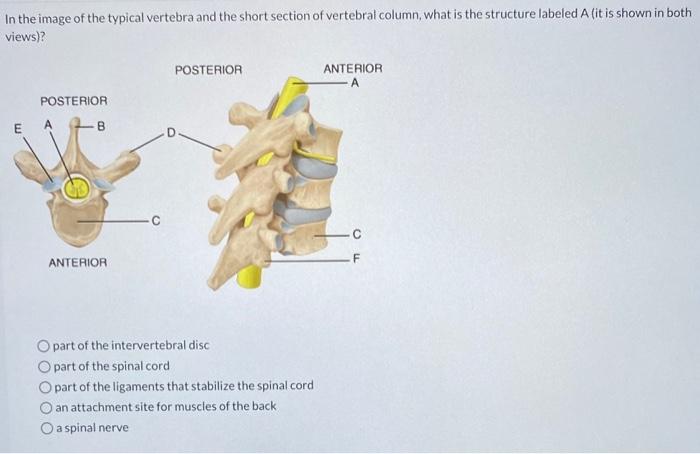 Solved In the image of the typical vertebra and the short | Chegg.com
