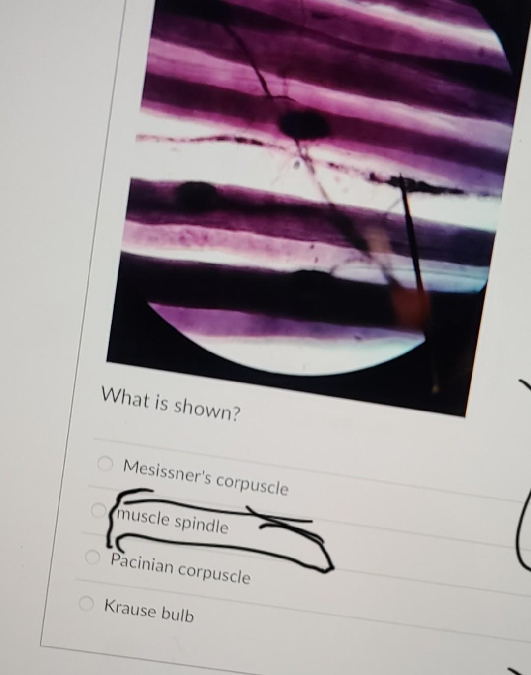 Solved endoneurium epineurium myelin perineurium Previous | Chegg.com