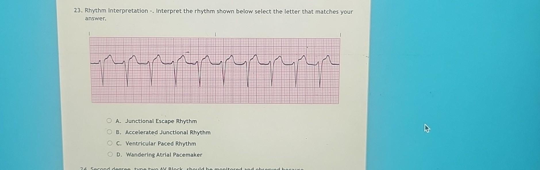 Solved 23. Rhythm Interpretation -. Interpret the rhythm | Chegg.com