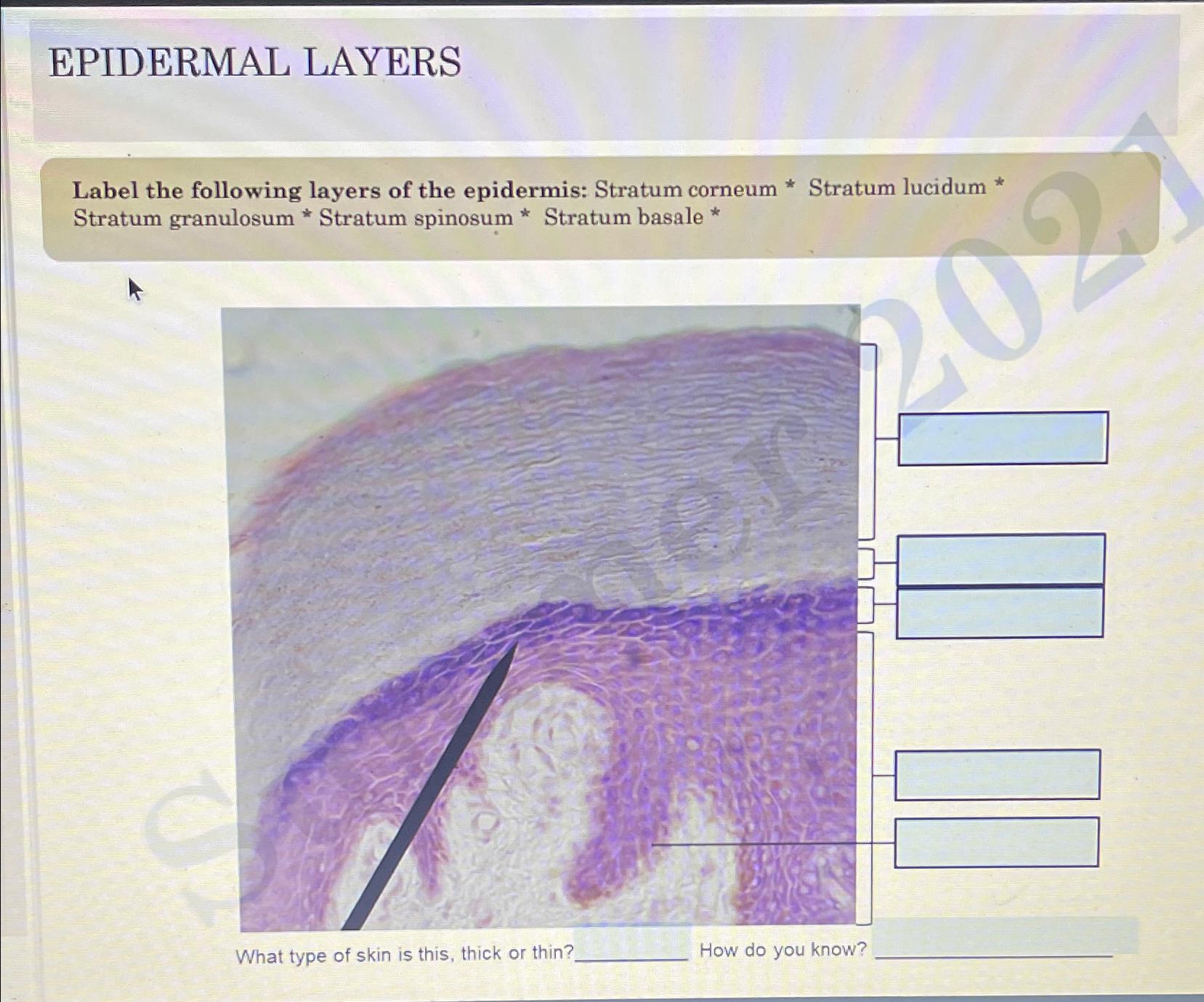 Solved EPIDERMAL LAYERSLabel the following layers of the | Chegg.com