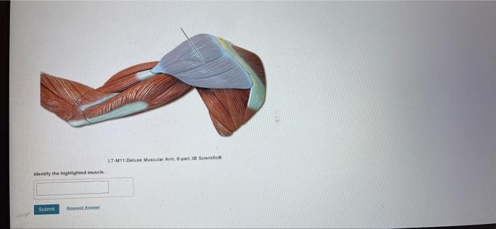 Solved LT-011 Deluxe Muscular Am-part 3 Schi Identify the | Chegg.com