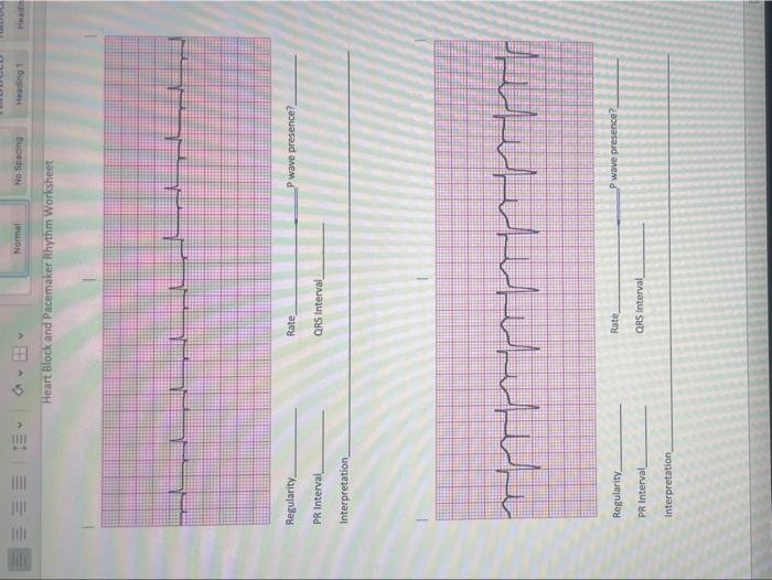 Solved Heart Block and Pacemaker Rhythm Worksheet Regularity | Chegg.com Solved Heart Block and Pacemaker Rhythm Worksheet Regularity | Chegg.com