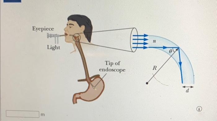 Solved Endoscopes are medical instruments used to examine | Chegg.com