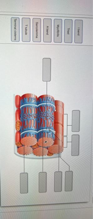Solved A band Sarcolemma T tubule Terminal cisterns | Chegg.com