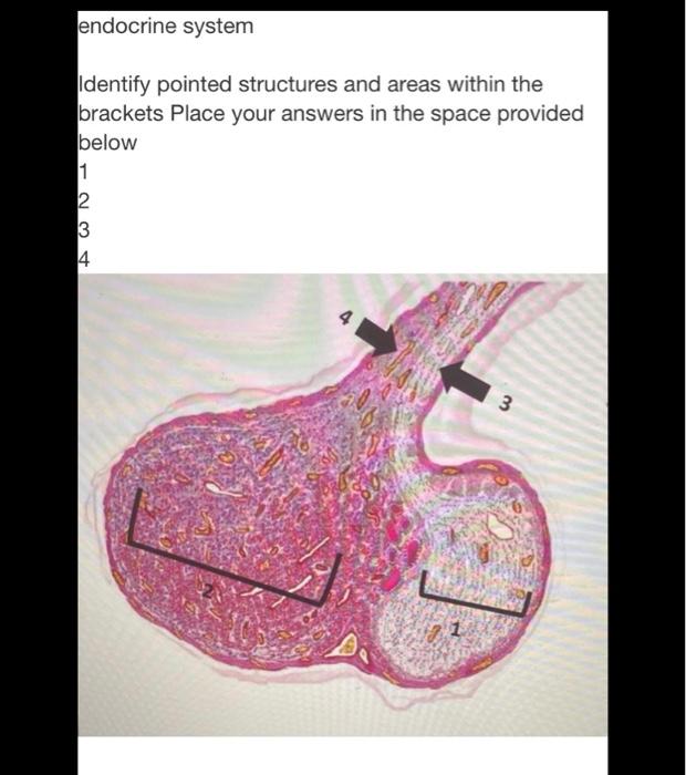 Solved endocrine system Identify pointed structures and | Chegg.com