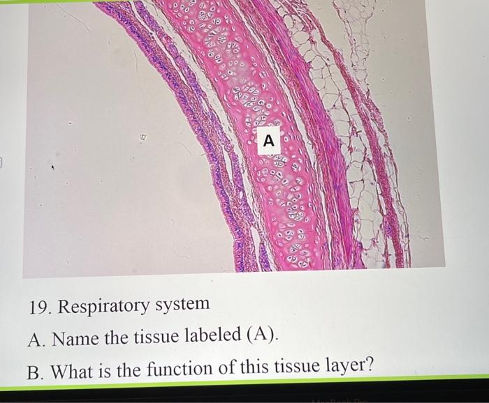 Solved A 7 19. Respiratory system A. Name the tissue labeled | Chegg.com