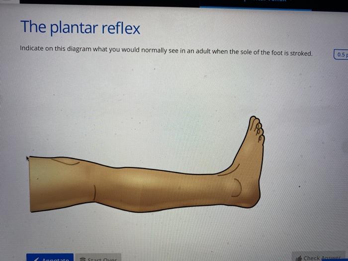 Solved The plantar reflex Indicate on this diagram what you | Chegg.com