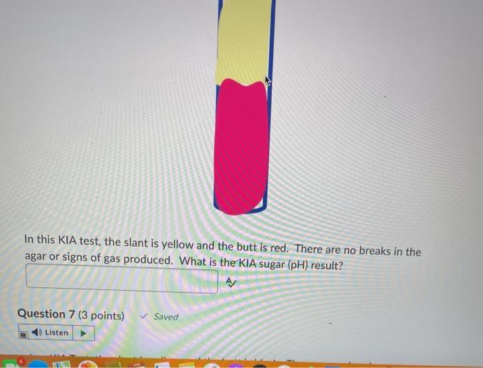 Solved In this KIA test, the slant is yellow and the butt is | Chegg.com