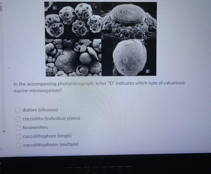 Solved C In the accompanying photomicrograph, letter "D" | Chegg.com