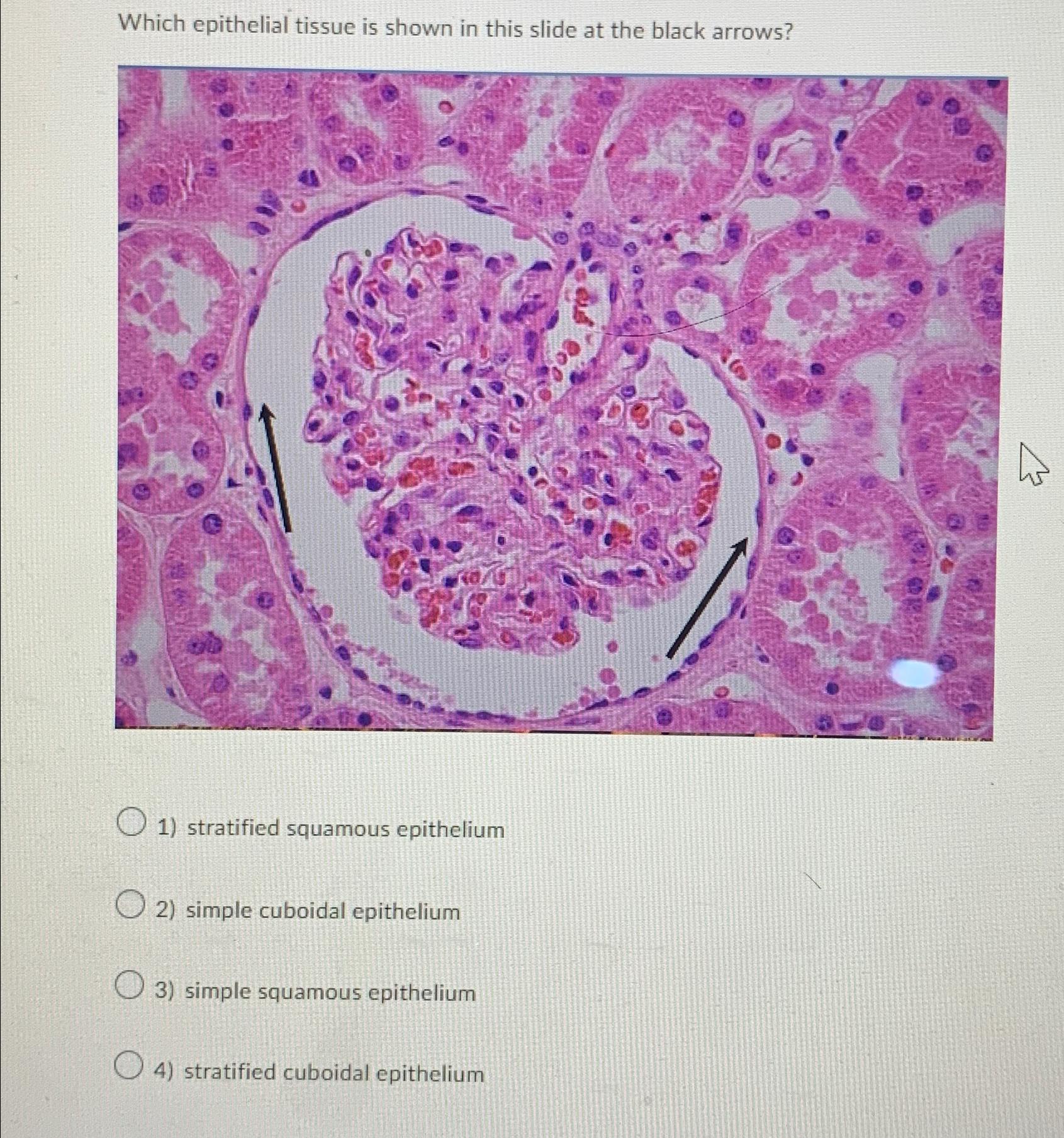 Solved Which epithelial tissue is shown in this slide at the | Chegg.com