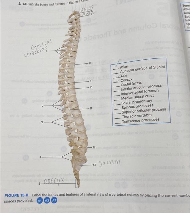 Solved LABEL 1-13, 2. Identify the bones and features in | Chegg.com