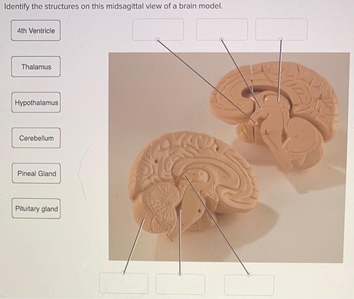 Solved Identify the structures on this midsagittal view of a | Chegg.com