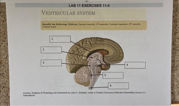 [Solved]: Identify the following Midbrain, Lateral ventride