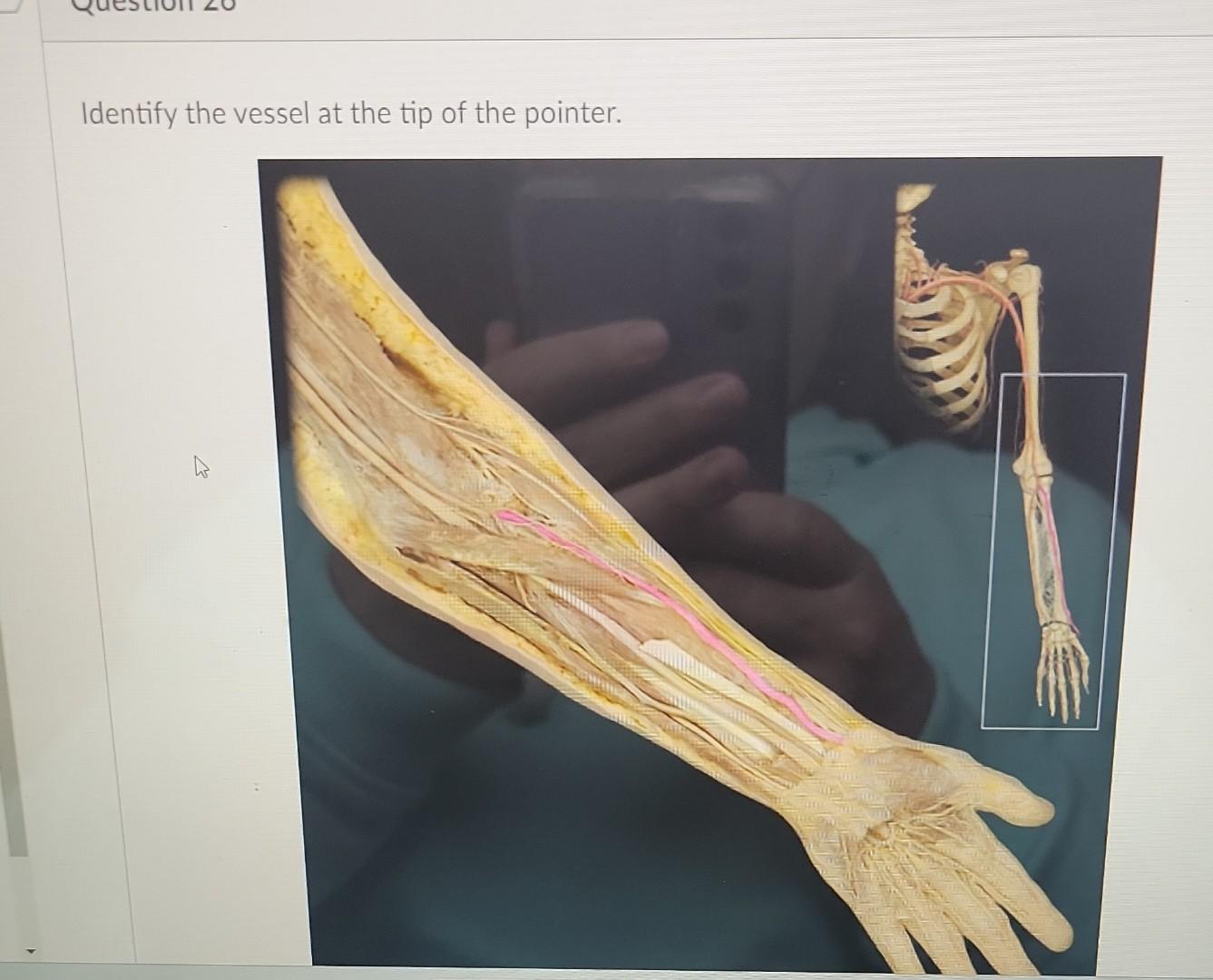 Solved y the vessel at the tip of the pointer.Identify the | Chegg.com