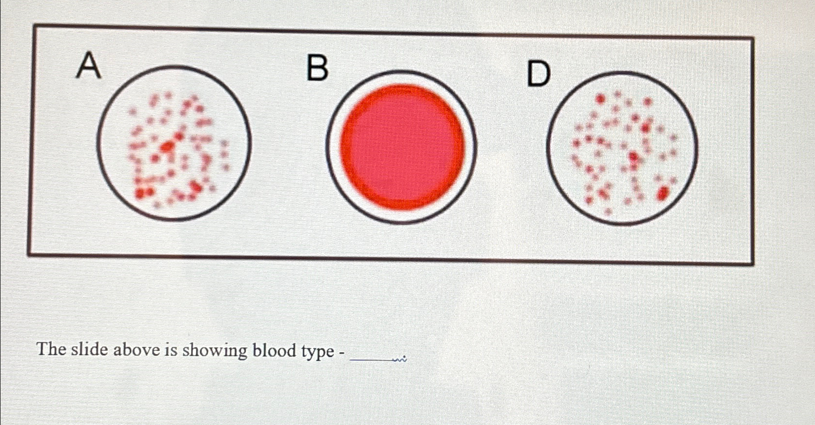 Solved AThe slide above is showing blood type - | Chegg.com