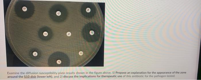 Solved Examine the diffusion susceptibility plate results | Chegg.com