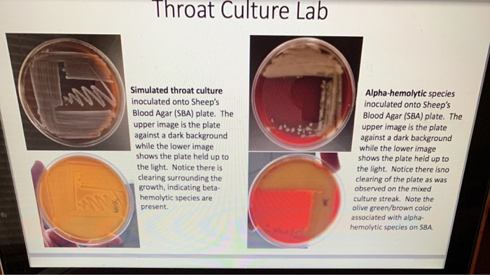 Solved Throat Culture Lab Simulated throat culture | Chegg.com