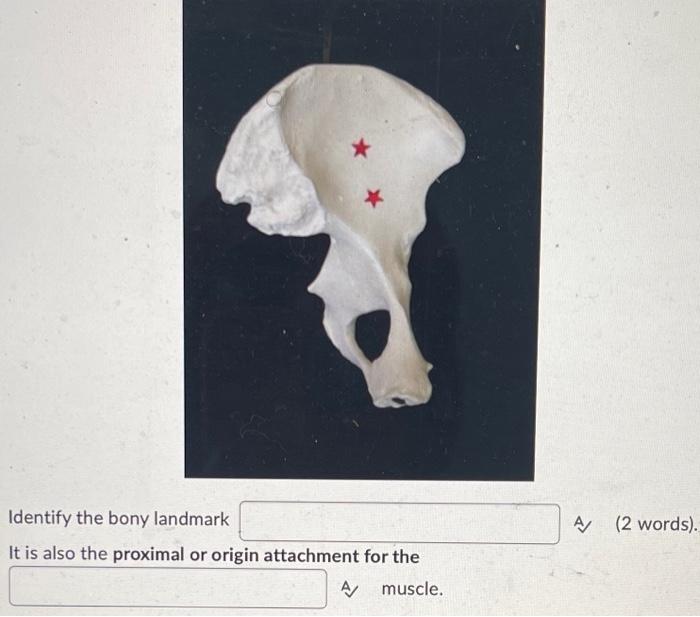Solved Identify the bony landmark It is also the proximal or | Chegg.com