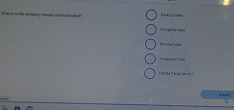 Solved Where is the primary visual cortex located?Parietal | Chegg.com