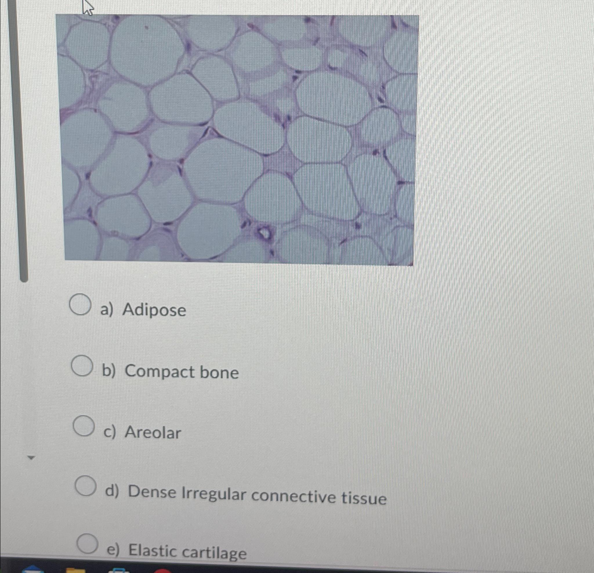 Solved a) ﻿Adiposeb) ﻿Compact bonec) ﻿Areolard) ﻿Dense | Chegg.com