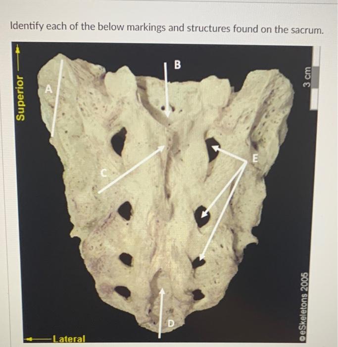 Solved Identify each of the indicated structures associated | Chegg.com