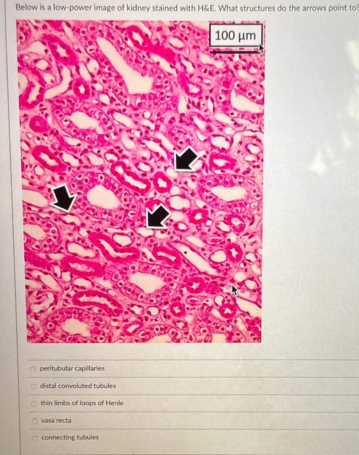 Solved Below is a low-power image of kidney stained with | Chegg.com