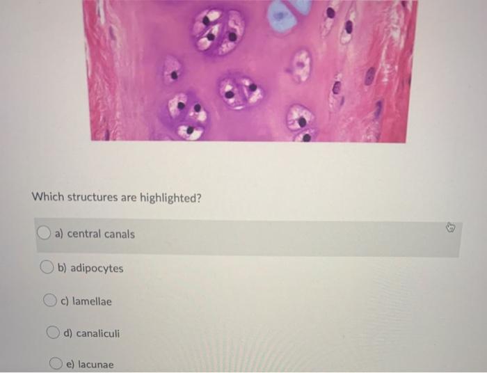 Solved Which structure is highlighted? a) chondrocyte b) | Chegg.com