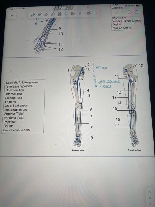 Solved Please label the following Veins. I have some listed | Chegg.com