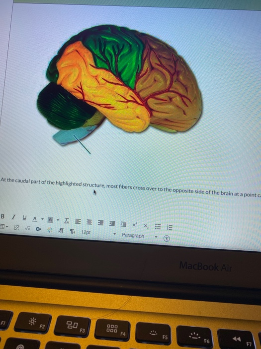 Solved At the caudal part of the highlighted structure, most | Chegg.com