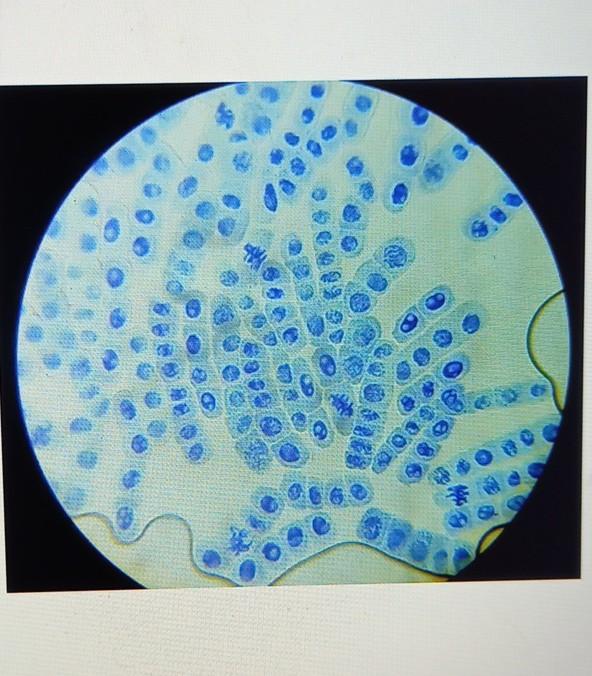 Mitotic Index = Number of dividing cells in the field | Chegg.com