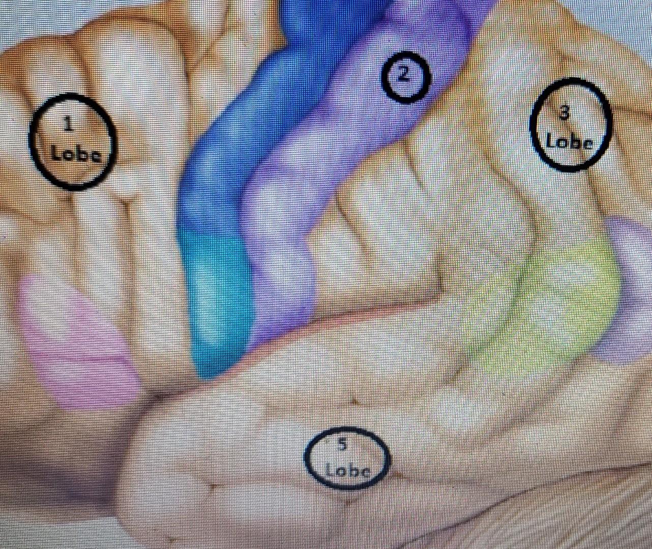 Solved © Lobe Lobe im Labe | Chegg.com