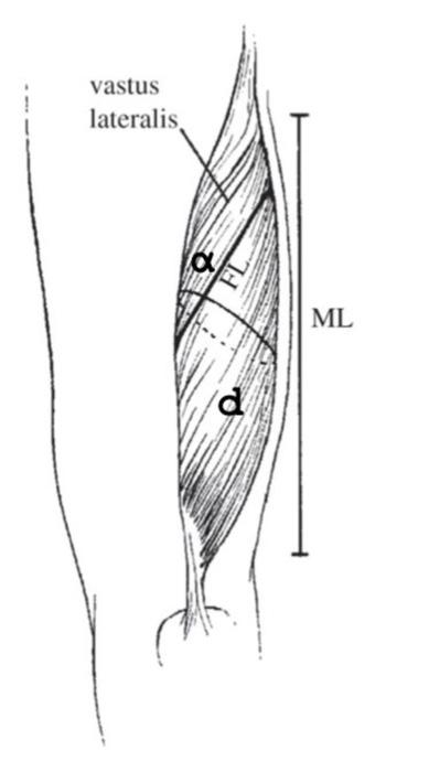 Solved vastus lateralis ML d | Chegg.com