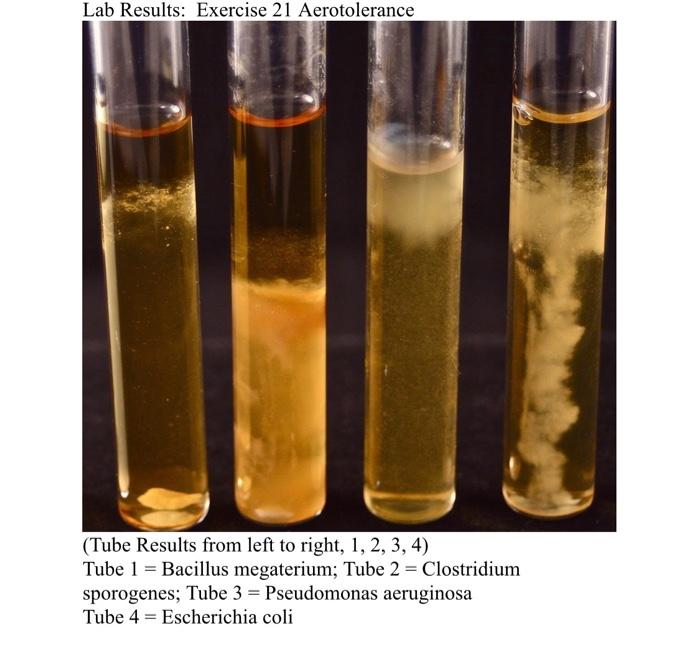 Solved Aerotolerance Your Results and Observations Draw or | Chegg.com