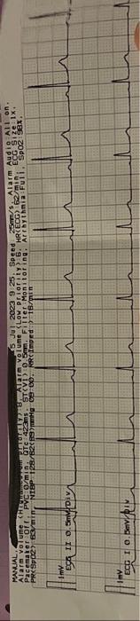 Solved Can you interpret this ekg stripRegularity-rate-P | Chegg.com