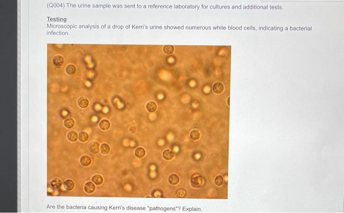 Solved (Q004) The urine sample was sent to a reference | Chegg.com