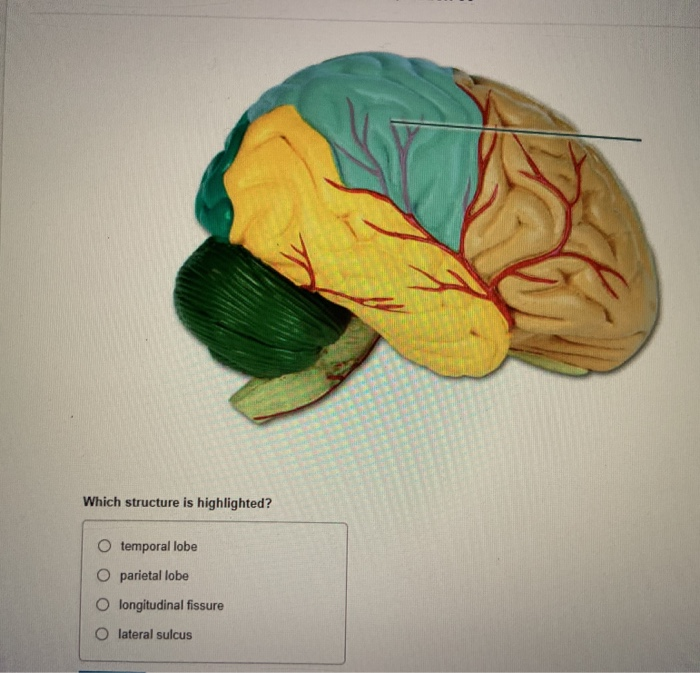Solved Which structure is highlighted? temporal lobe O | Chegg.com