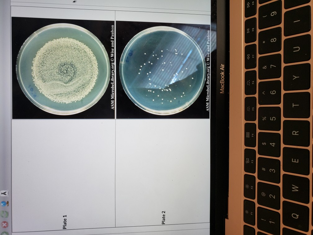 Solved Plate 1 ASM MicrobeLibrary.org O Wise and Paulson | Chegg.com
