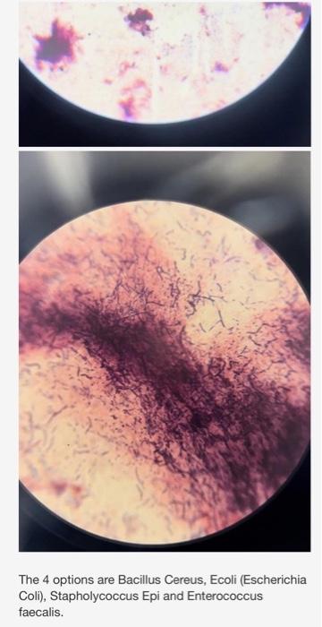 Solved Based on the pictures below, what organism is the | Chegg.com