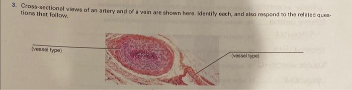 Solved Cross-sectional views of an artery and of a vein are | Chegg.com